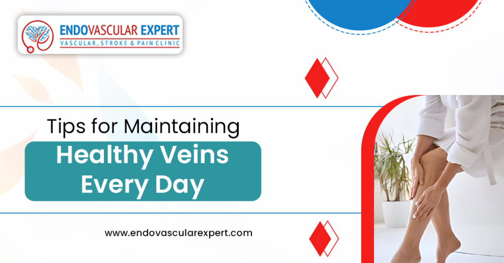 Tips to Maintain Healthy Veins Daily | Varicose Vein Treatment in Jaipur