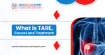 What is TARE | Causes and Treatment - Expert Insights